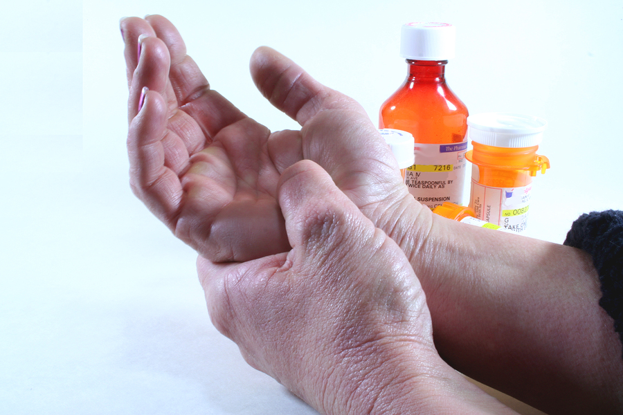 Important Points About Peripheral Neuropathy That You Need To Know ...